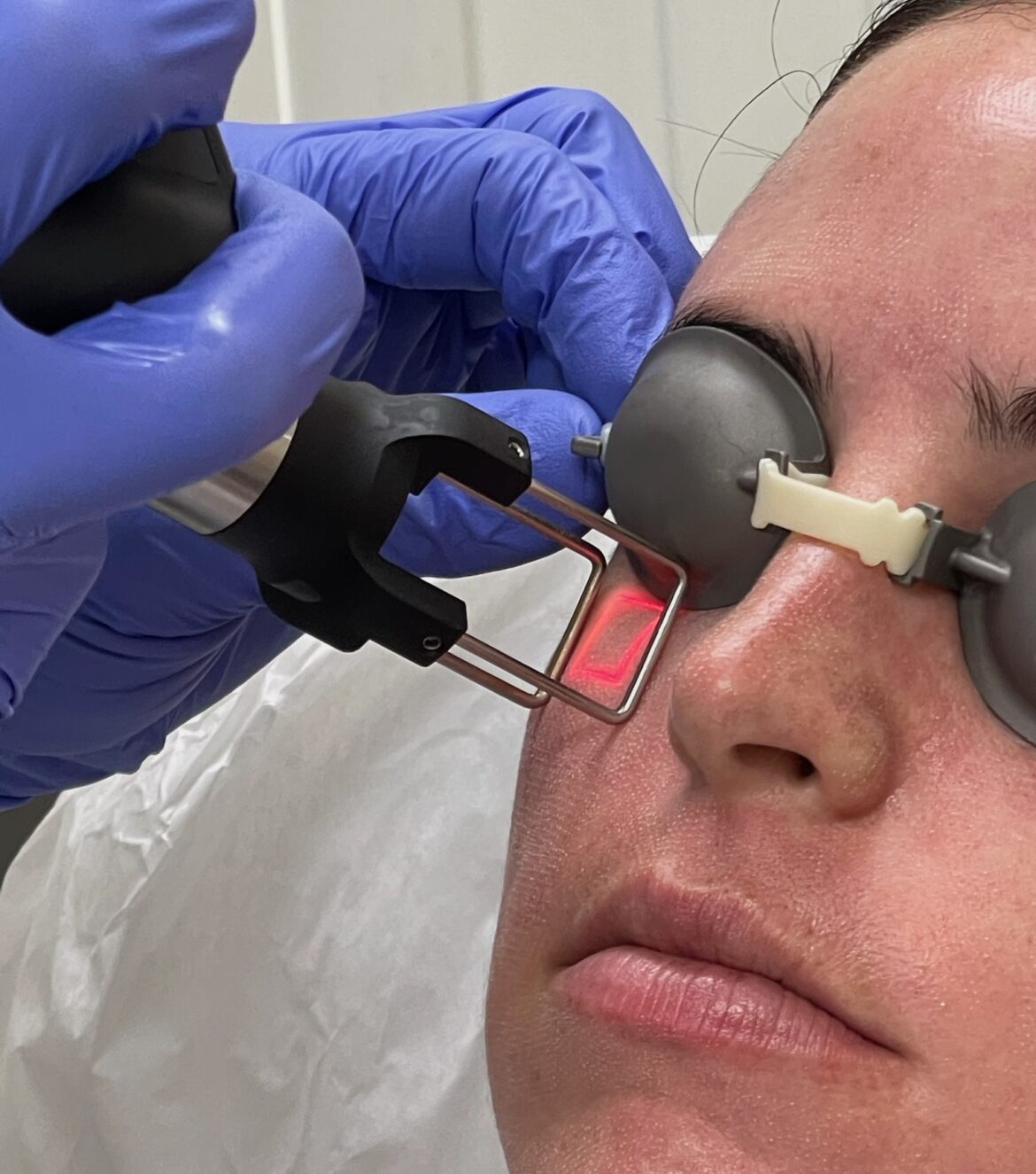 Cosmetic Treatments in Verona: True Bliss Medical Aesthetics + Wellness ...